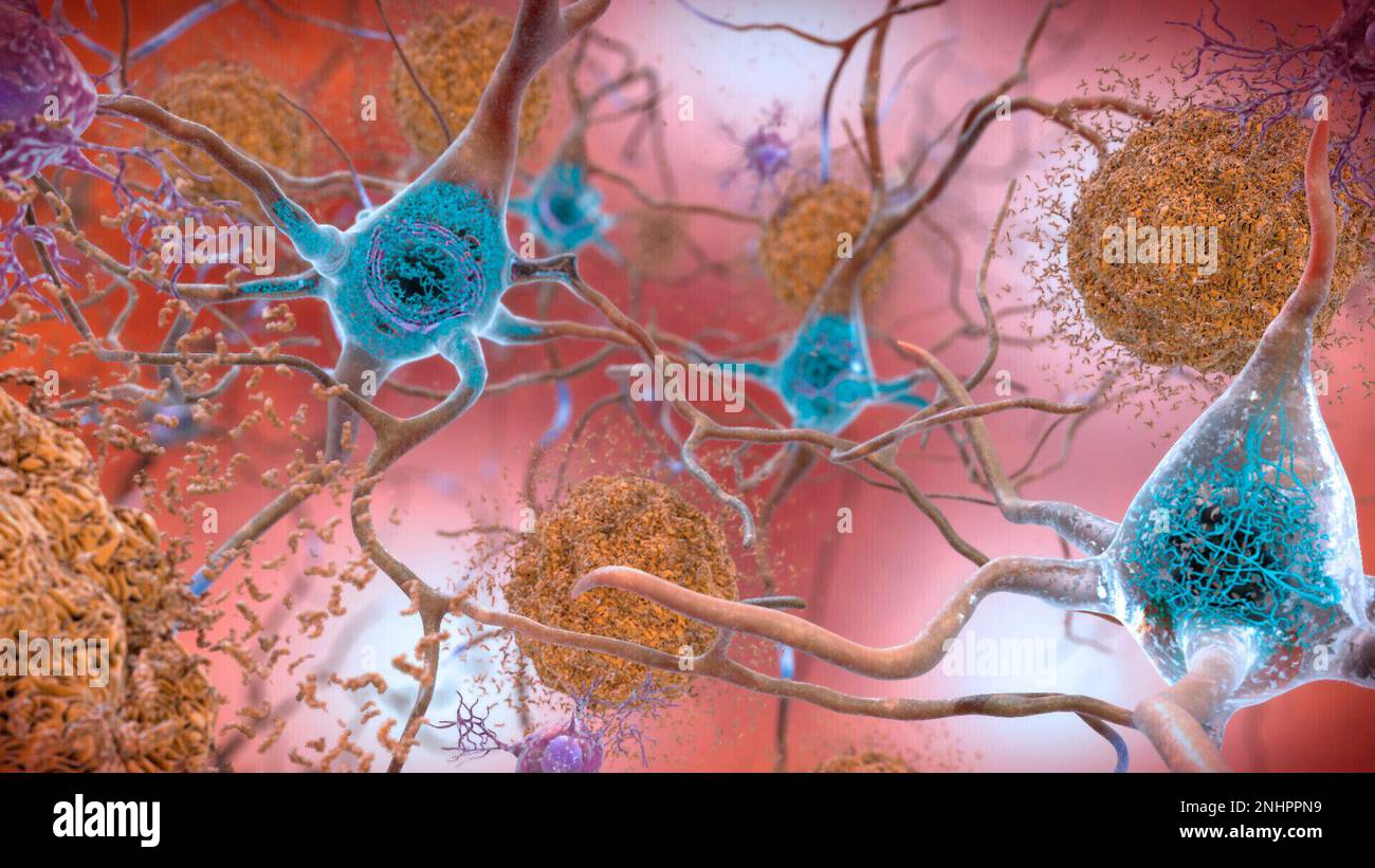 This illustration made available by the National Institute on Aging ...