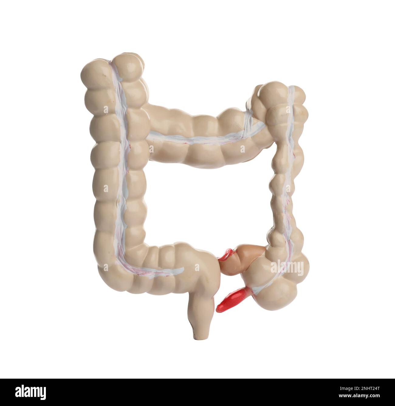 Anatomical model of large intestine isolated on white. Gastroenterology ...