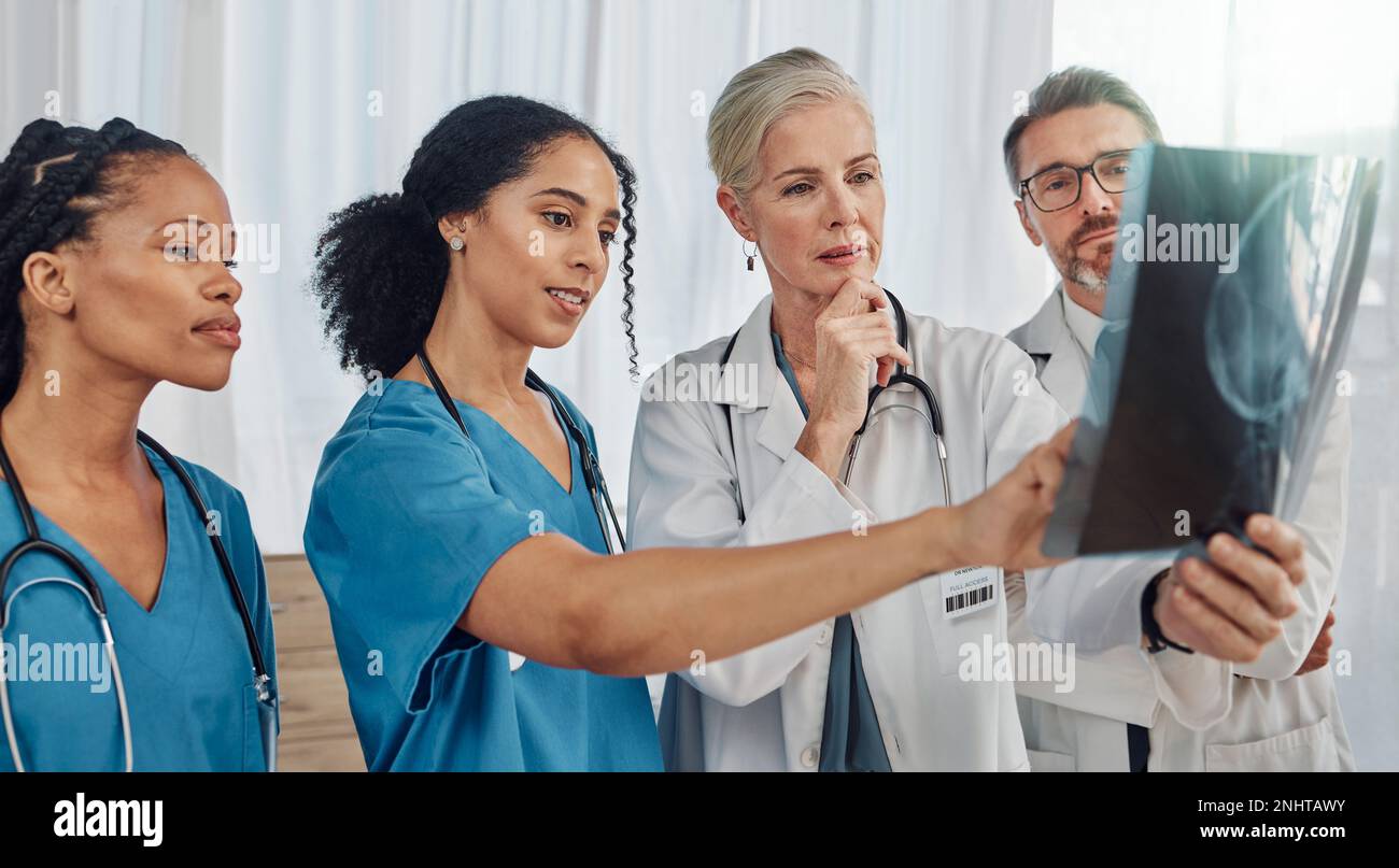 Xray, doctors and nurses, team and health with analysis of brain scan ...