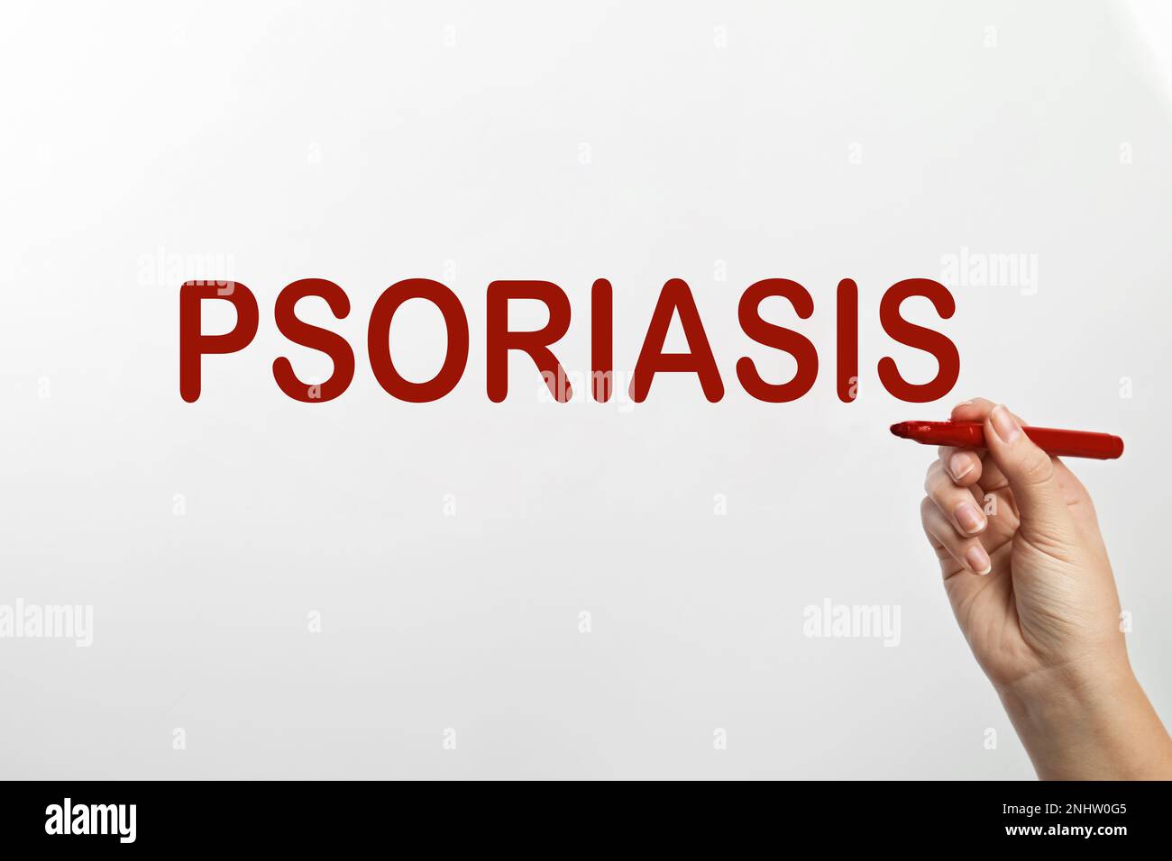 Woman writing word PSORIASIS on white background, closeup Stock Photo ...