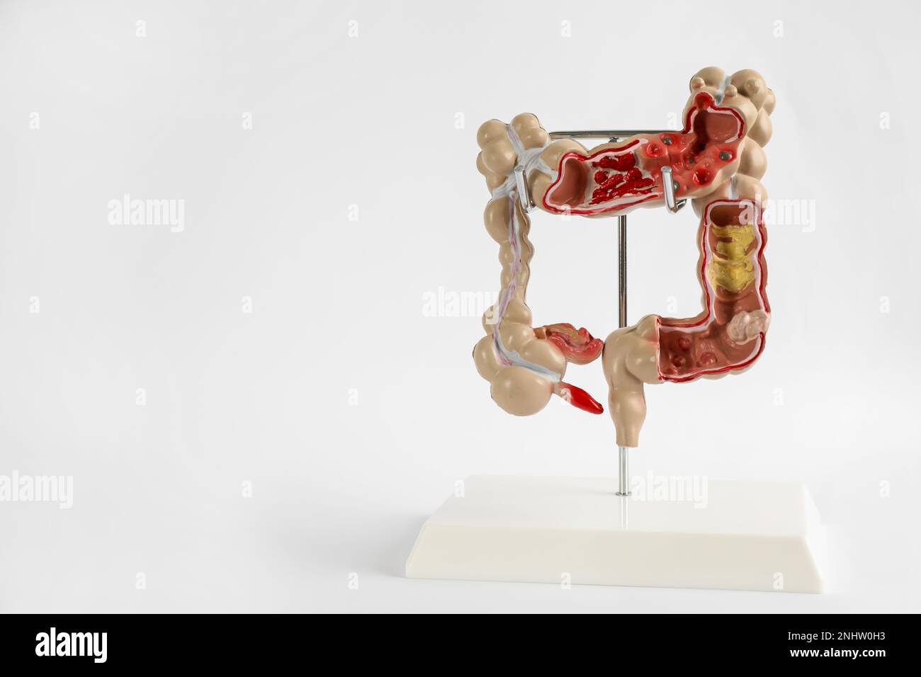 Human colon model on light background. Space for text Stock Photo - Alamy