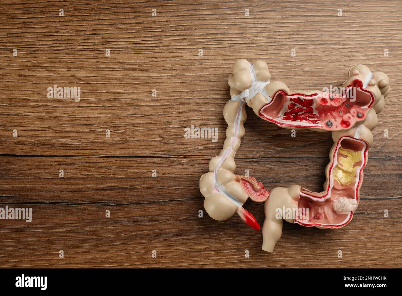 Human colon model on wooden table, top view. Space for text Stock Photo ...