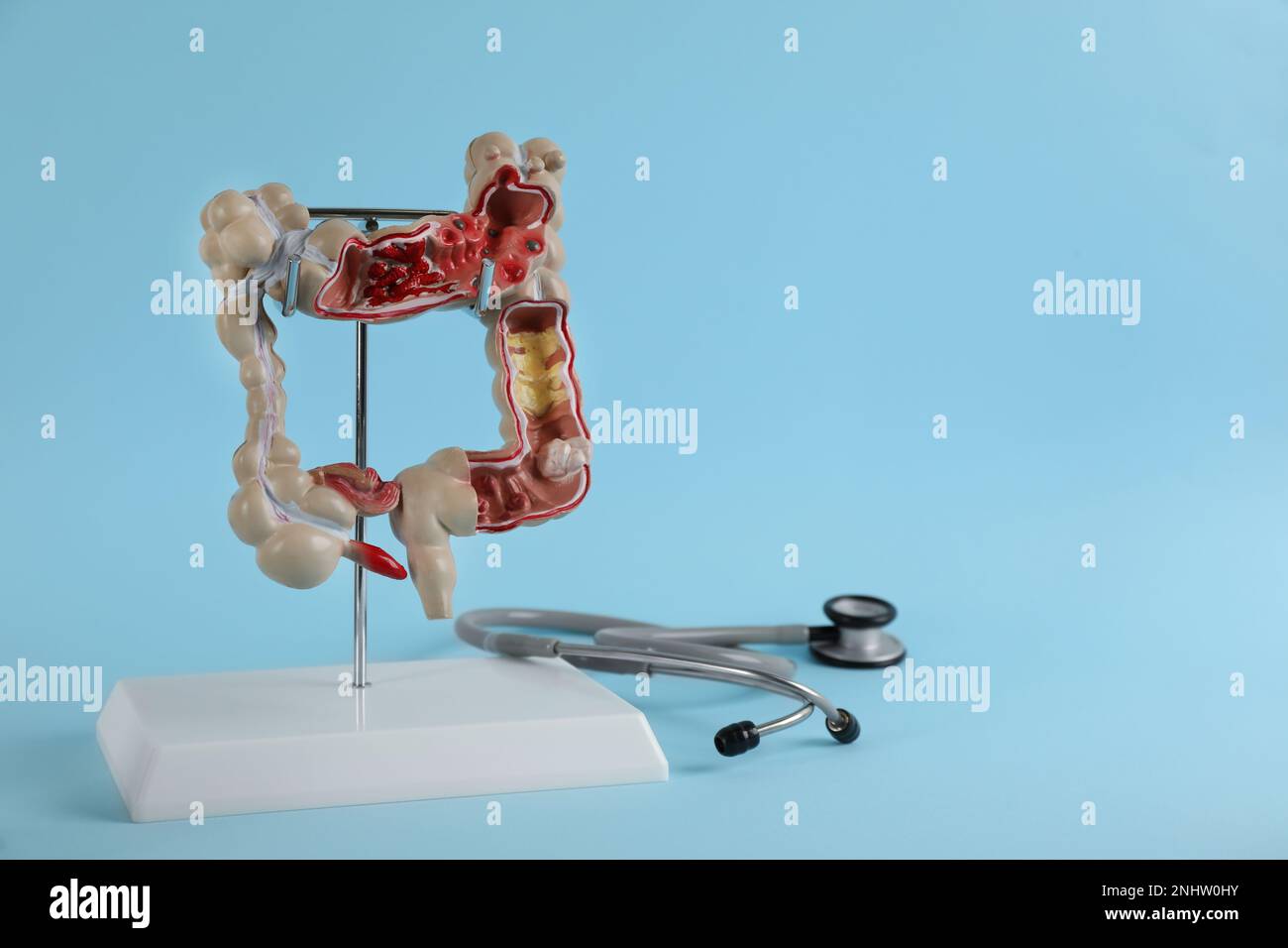 Human colon model and stethoscope on light blue background. Space for ...