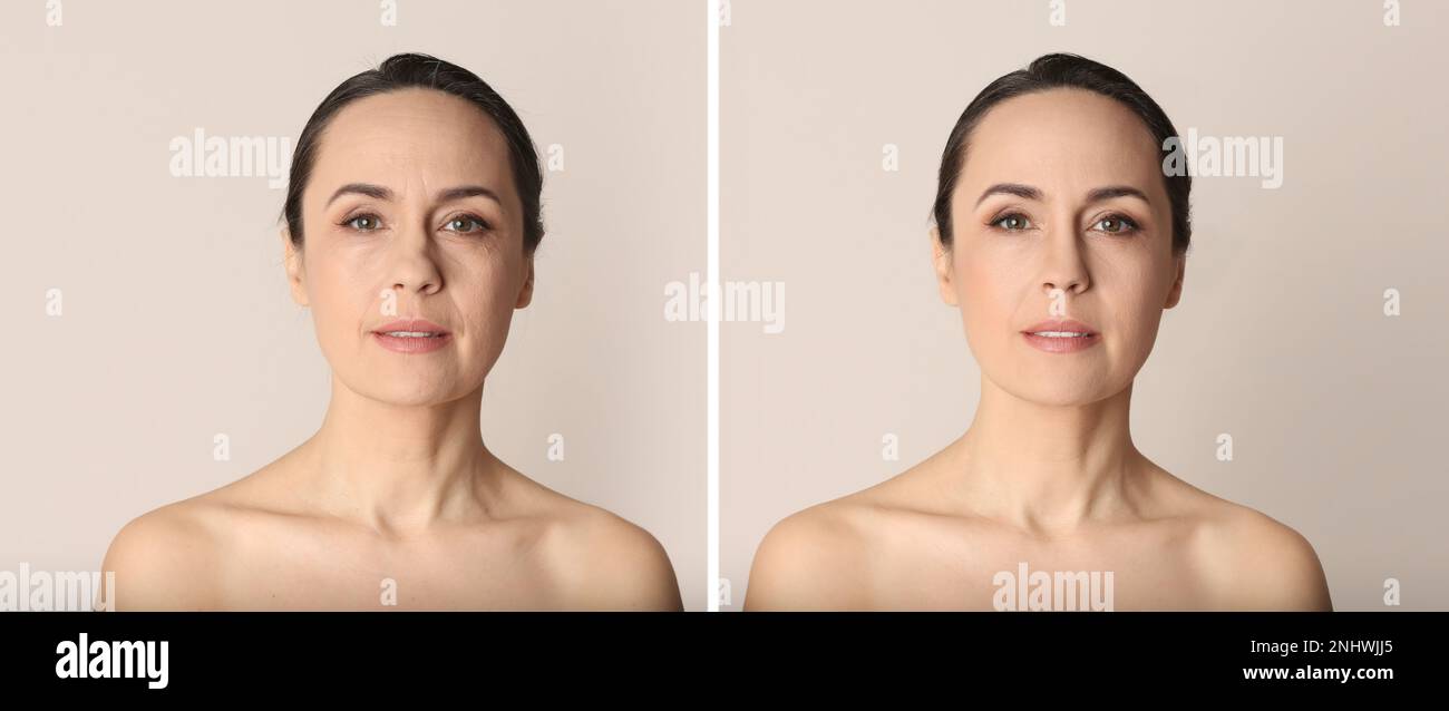 Photo before and after retouch, collage. Portrait of beautiful mature ...