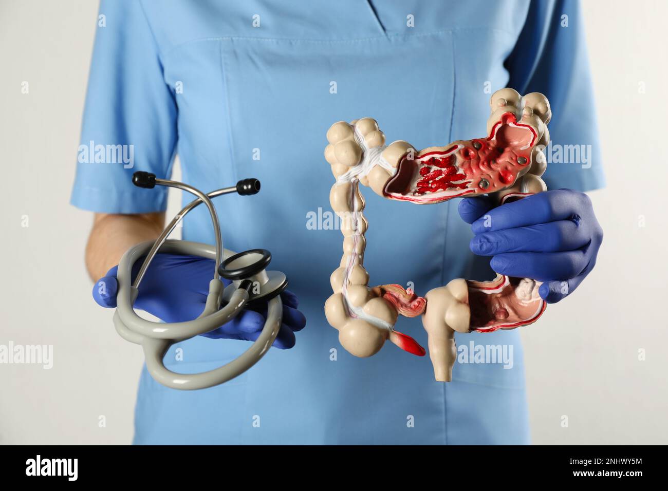 Gastroenterologist holding human colon model and stethoscope on white ...