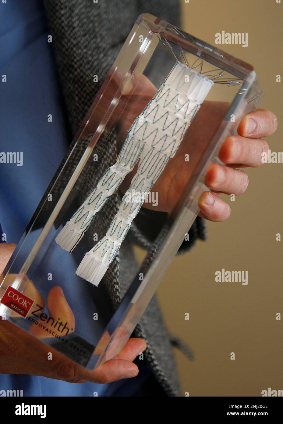 UCSF professor of surgery Timothy Chuter shows what a bifurcated ...