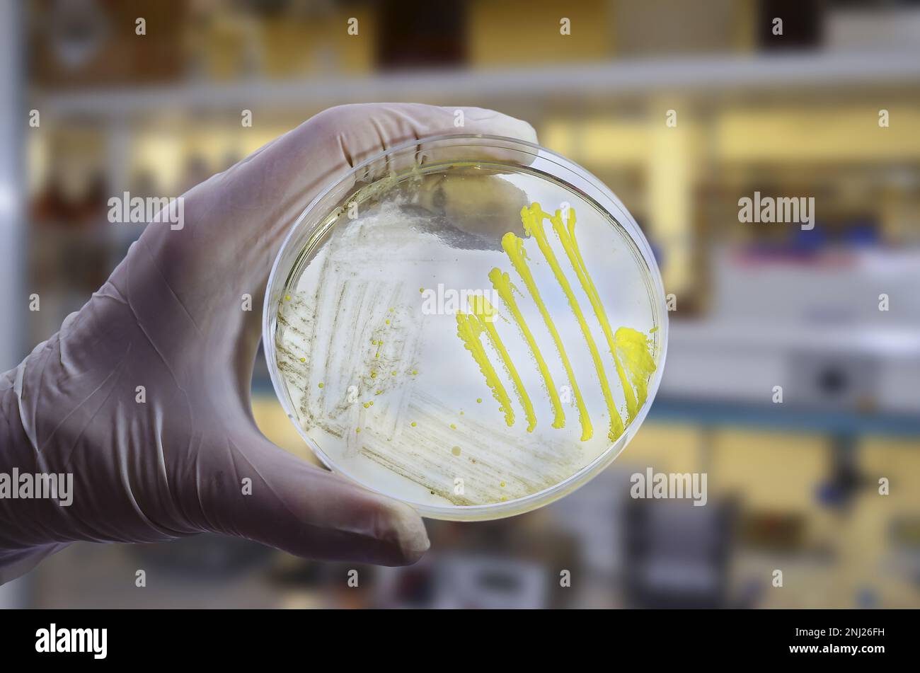 Nutrient agar plate hi-res stock photography and images - Alamy