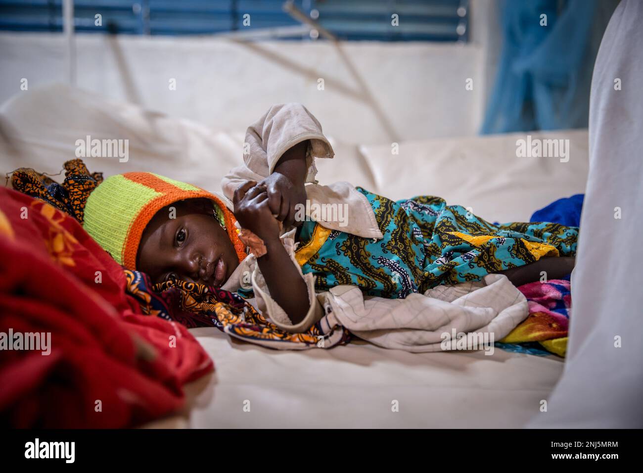 A child is treated for malnutrition in a hospital in Aguié, southern ...