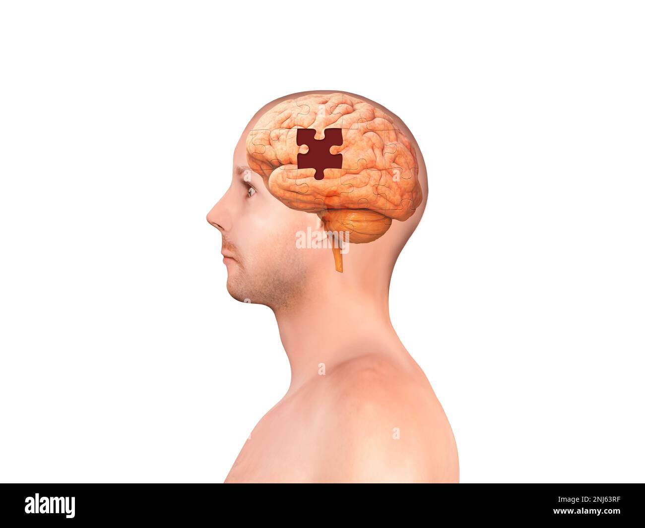 Brain shaped white jigsaw puzzle on white background, a missing piece ...