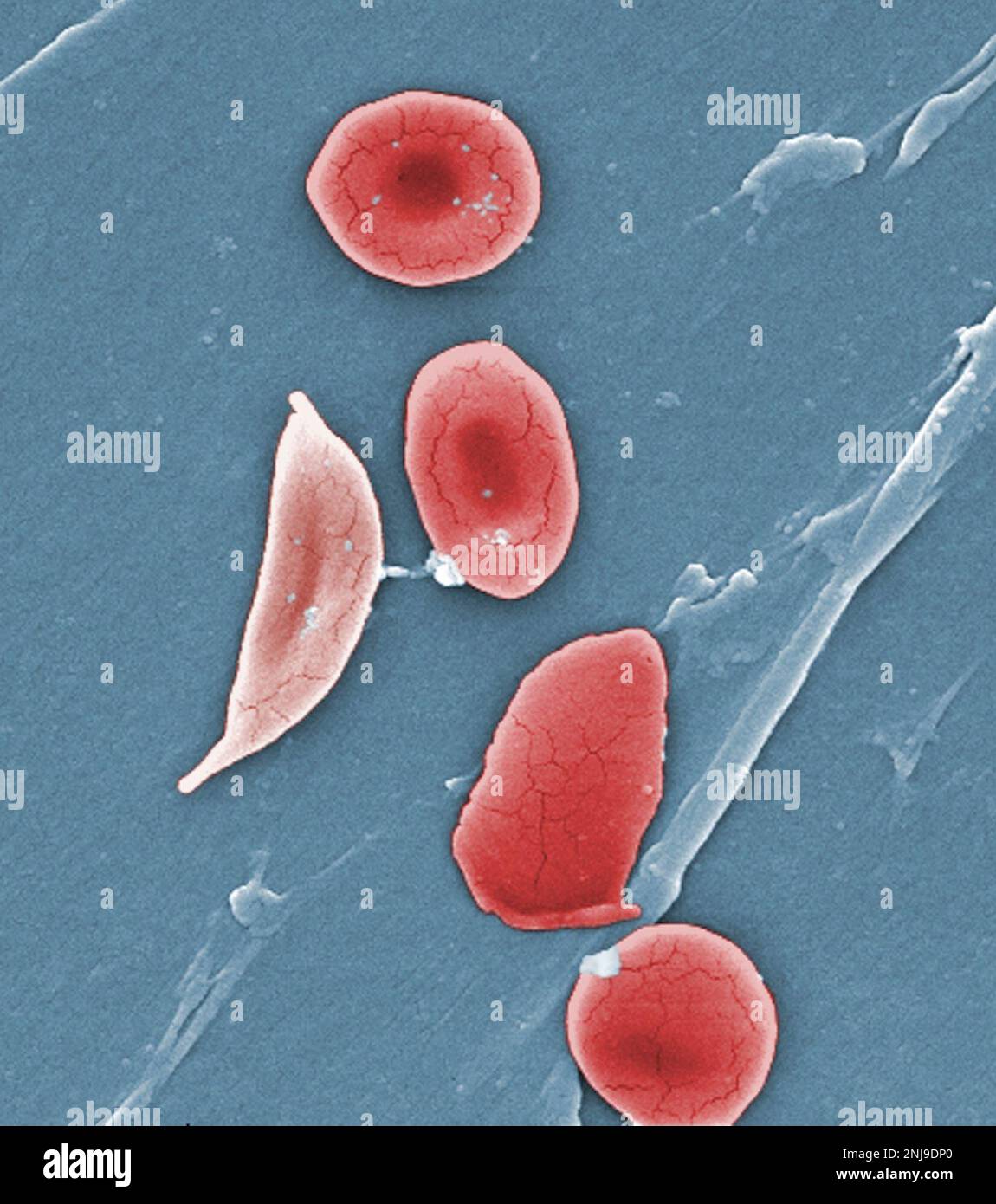 FILE - This 2009 colorized microscope image made available by the ...