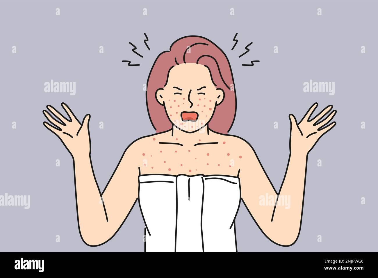 Angry woman in towel shout distressed with red body inflammation ...