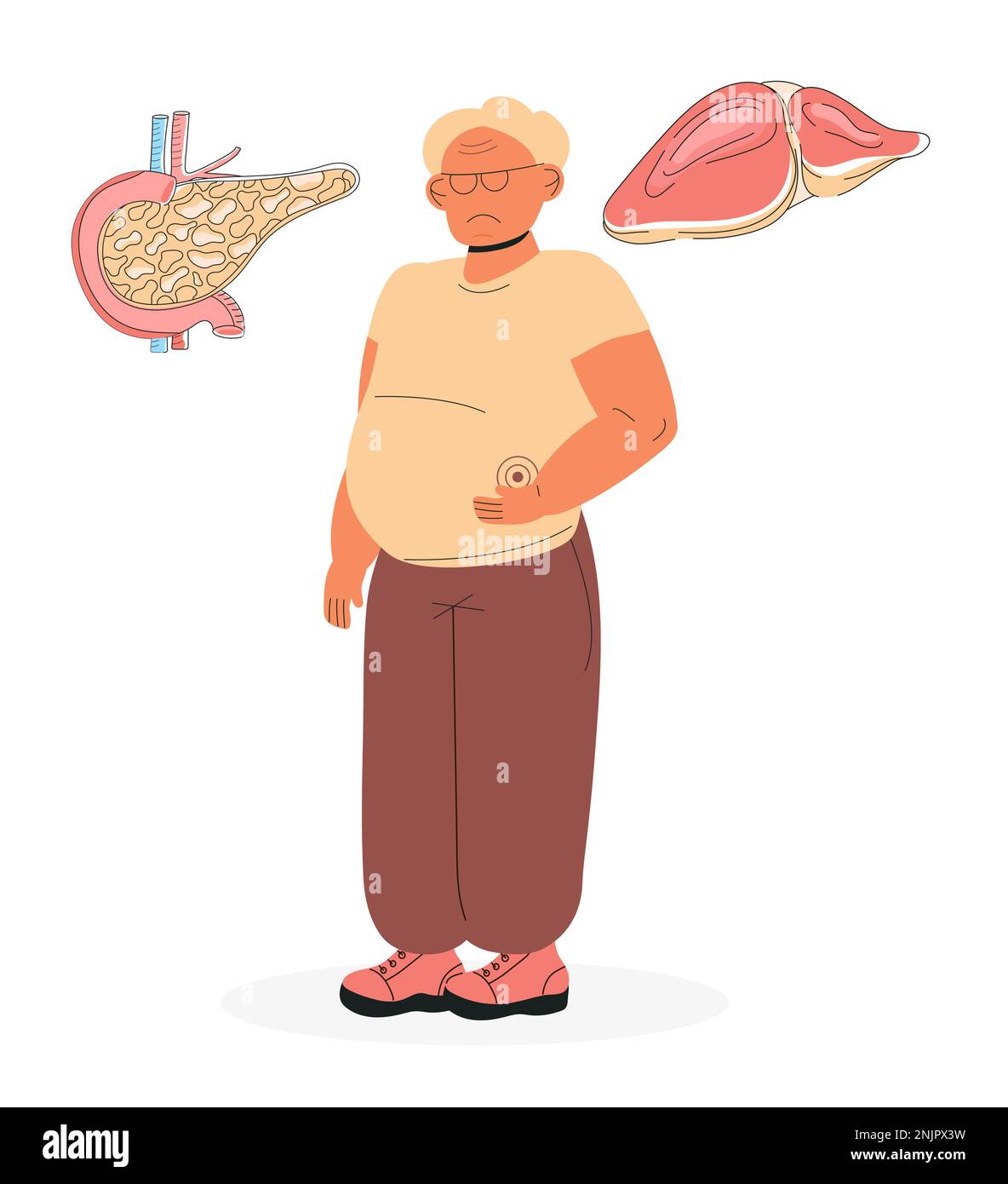 Hepatology concept vector for medical website. Illness patient. Concept ...