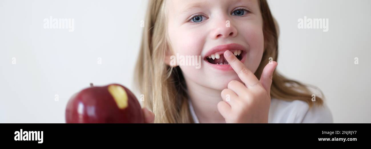 Girl without teeth smiling hi-res stock photography and images - Alamy