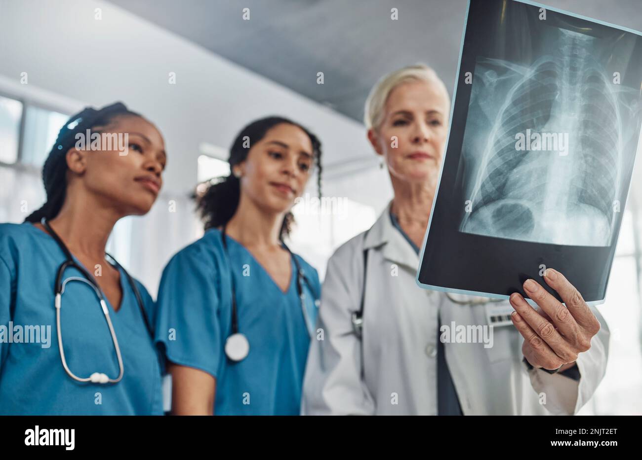 Xray, doctor and nurses, team and medicine with analysis of lung scan ...