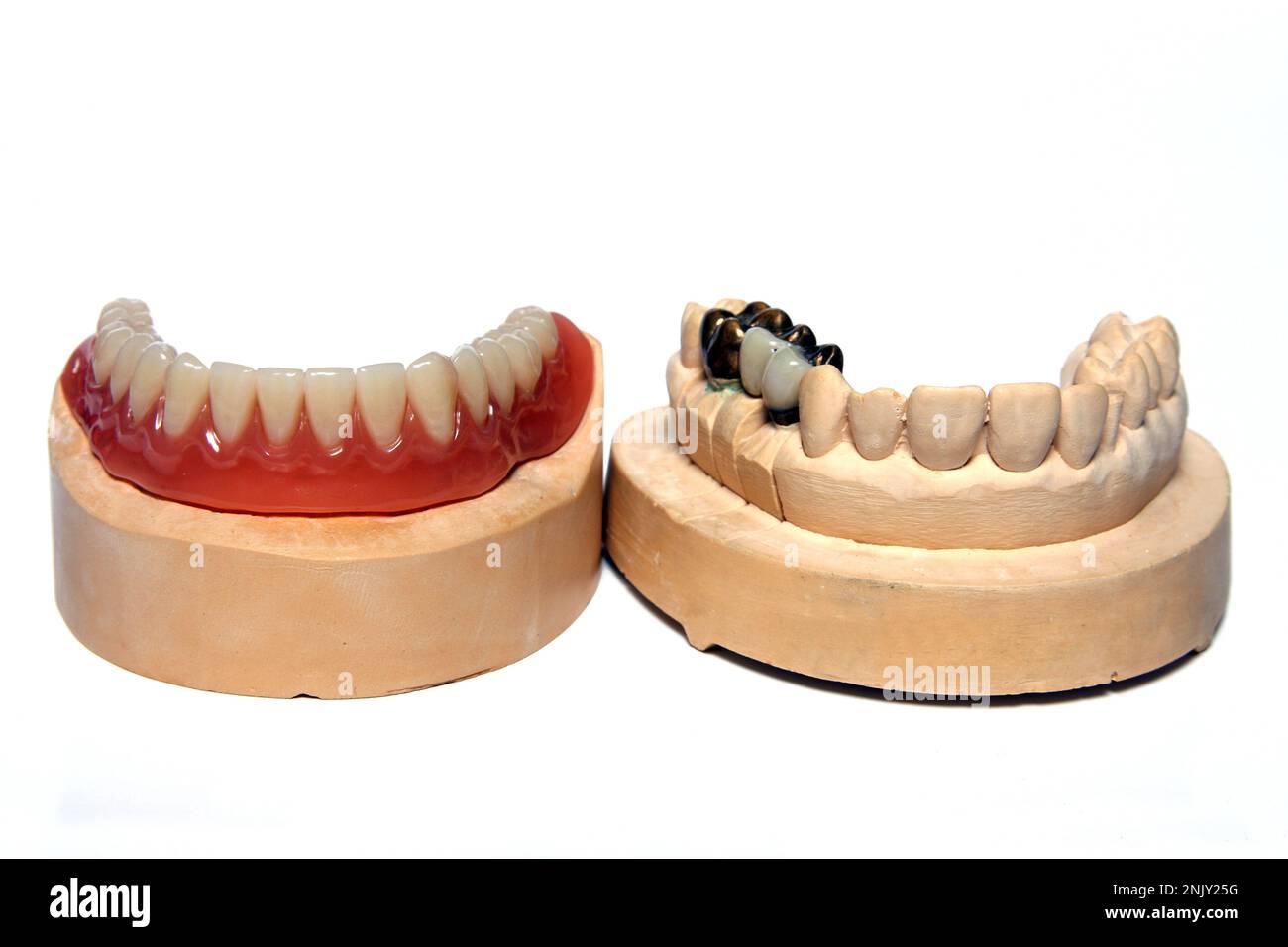 Types Of Dental Models at Brayden Woodd blog
