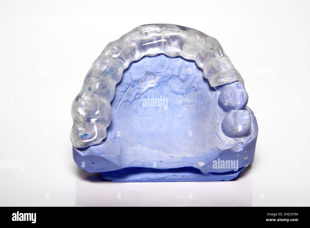 denture impression with grinding splint Stock Photo - Alamy