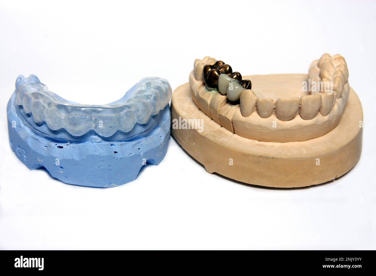 Crown and bridge impressions hi-res stock photography and images - Alamy