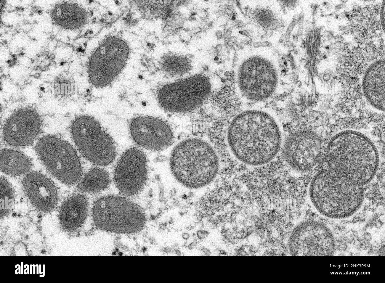 FILE - This 2003 electron microscope image made available by the ...