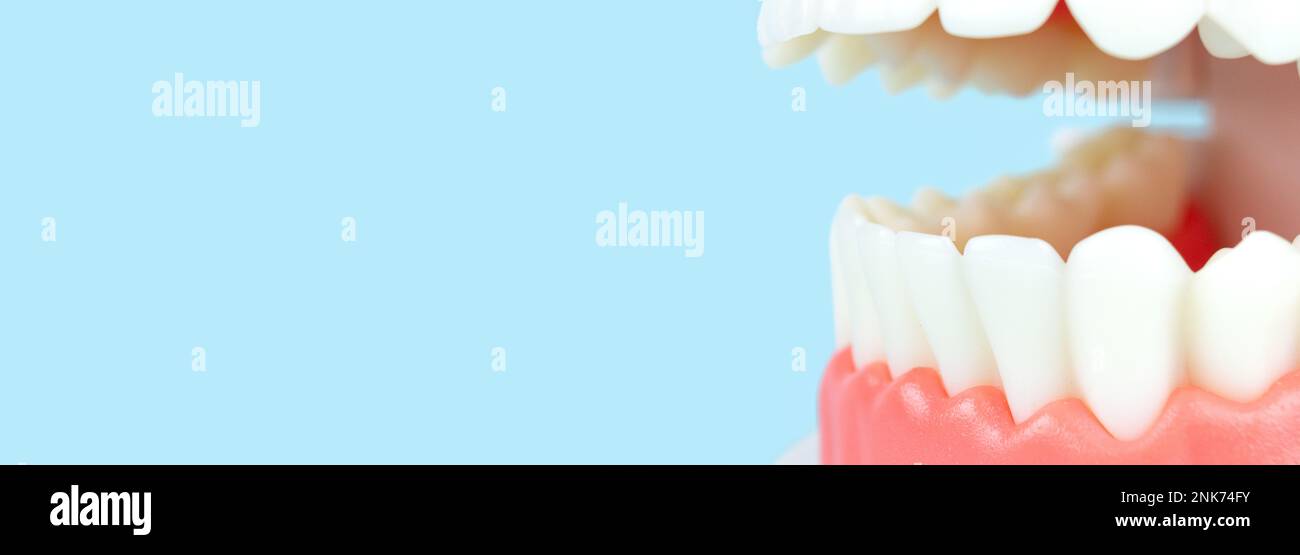 Dentistry conceptual photo. Close-up individual tooth tray Orthodontic ...