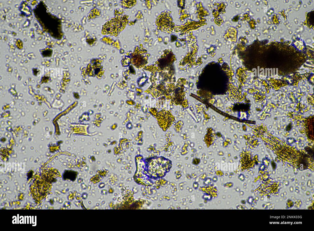 soil microorganisms in a soil sample, soil fungus and bacteria on a ...