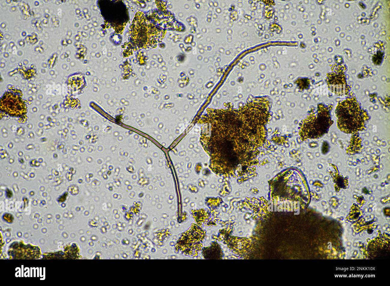 soil microorganisms in a soil sample, soil fungus and bacteria on a ...