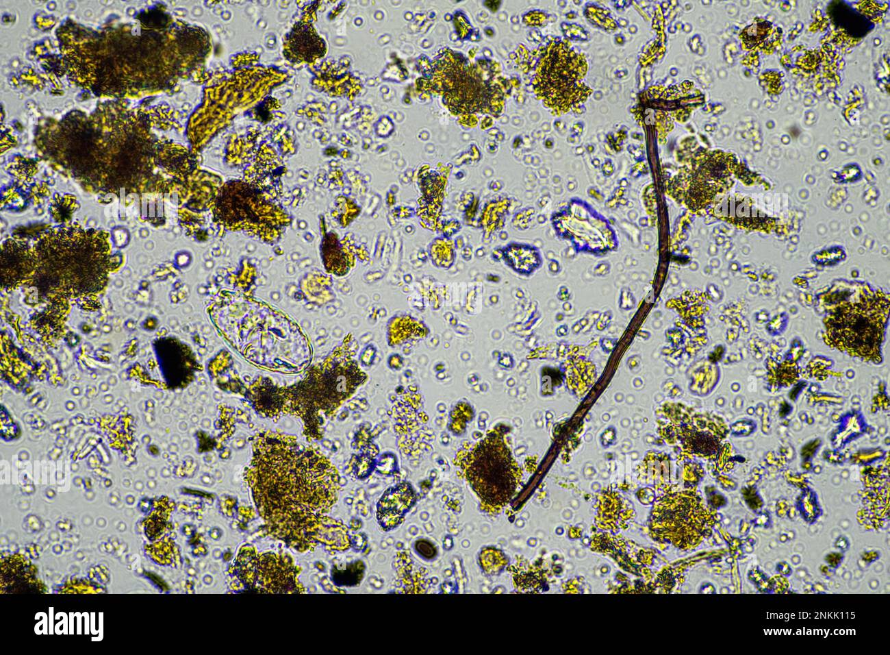 soil microorganisms in a soil sample, soil fungus and bacteria on a ...