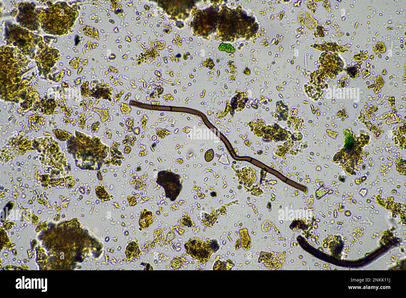 soil microorganisms in a soil sample, soil fungus and bacteria on a ...