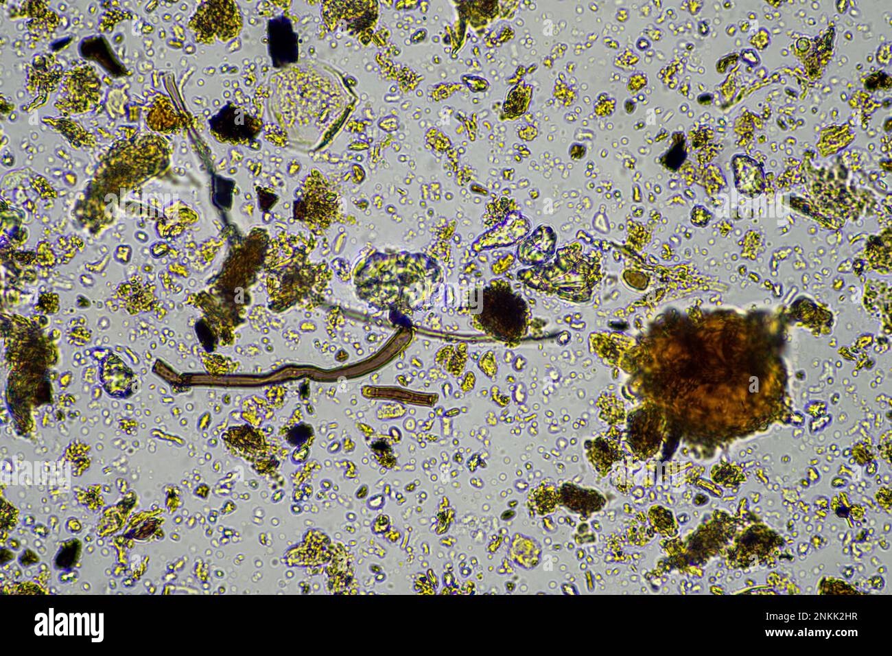 soil microorganisms in a soil sample, soil fungus and bacteria on a ...