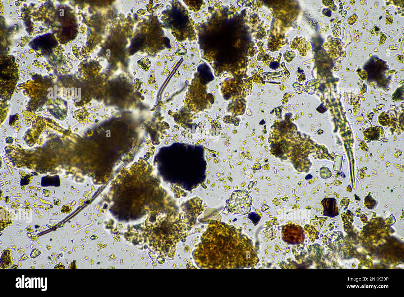 soil microorganisms in a soil sample, soil fungus and bacteria on a ...