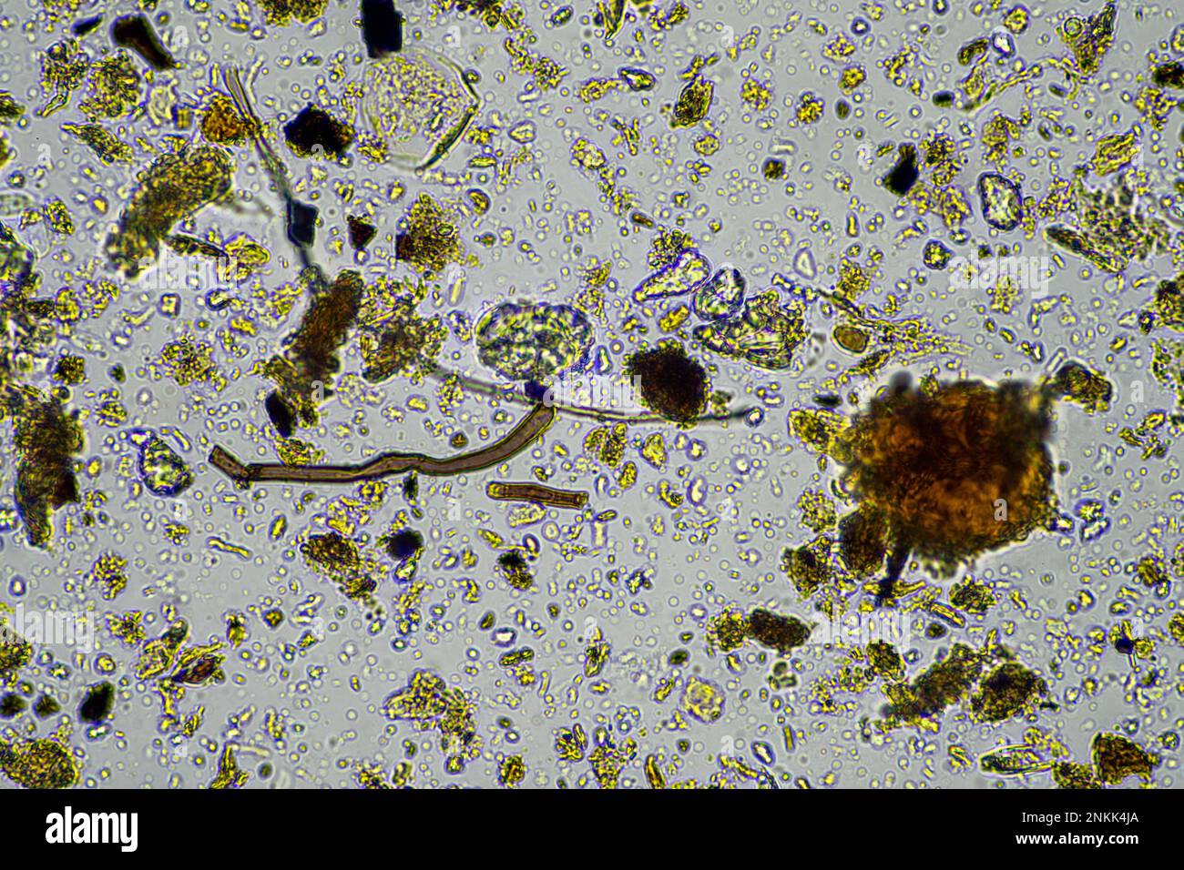 soil microorganisms in a soil sample, soil fungus and bacteria on a ...