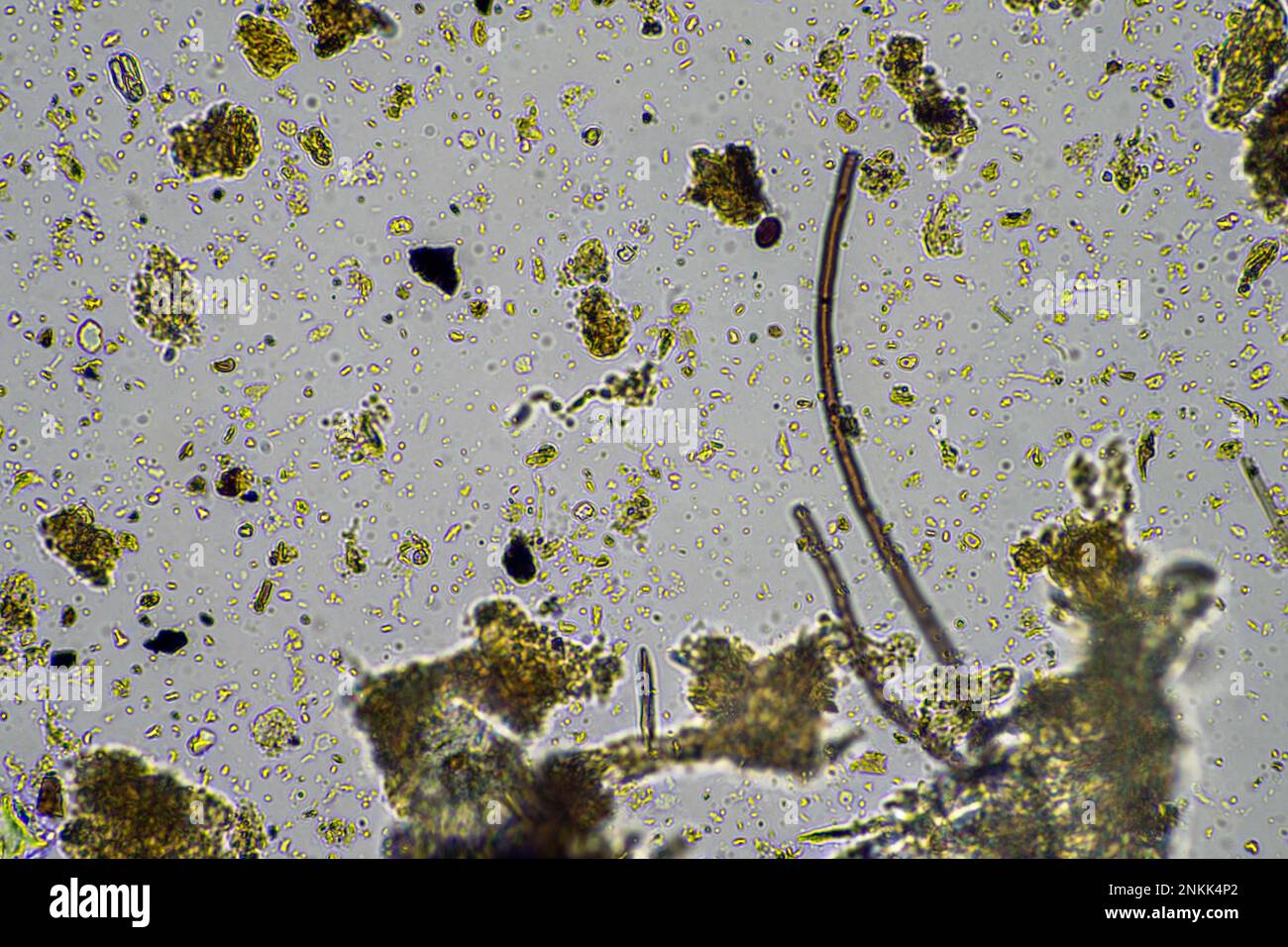 soil microorganisms in a soil sample, soil fungus and bacteria on a ...