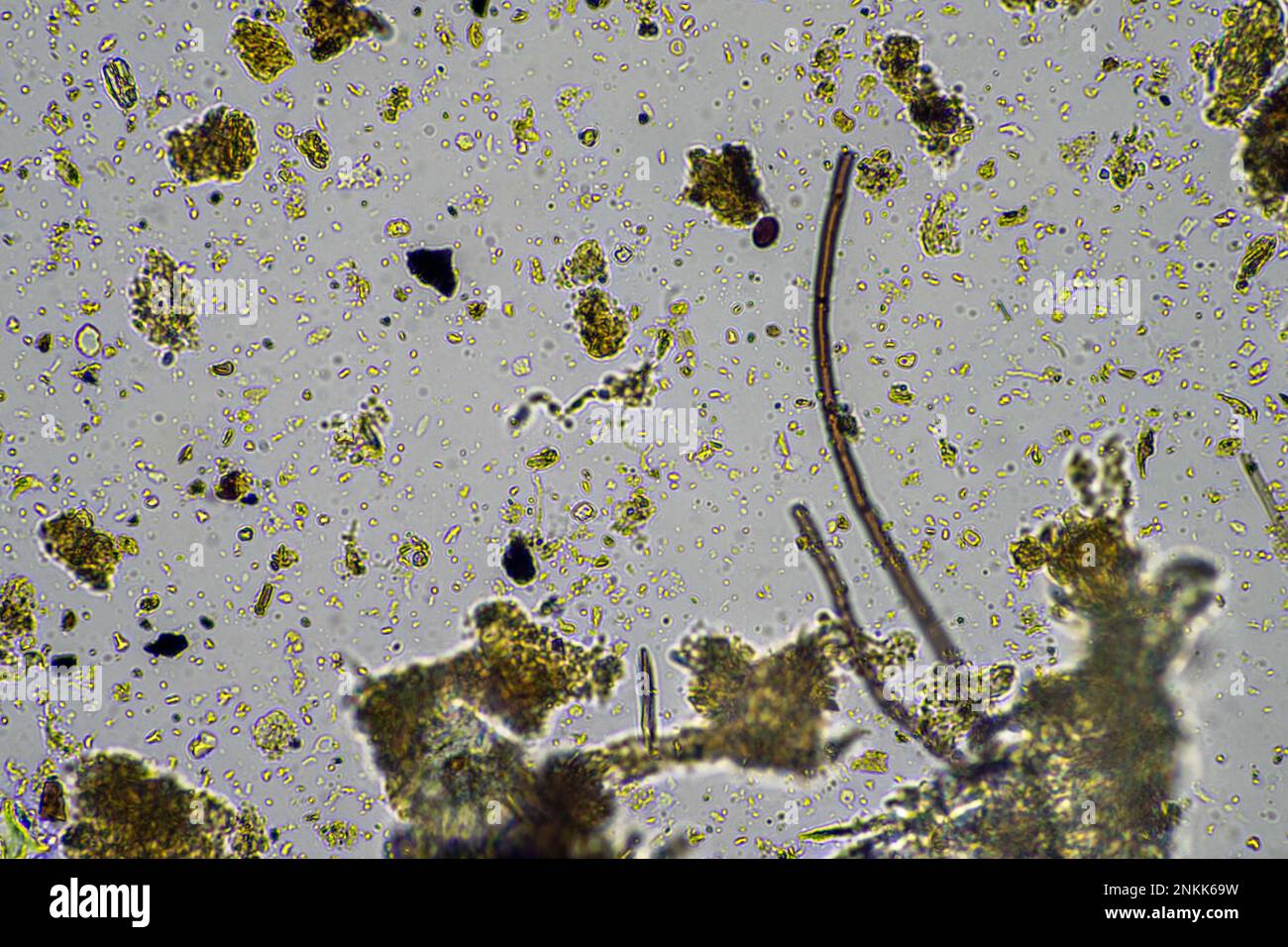 soil microorganisms in a soil sample, soil fungus and bacteria on a ...