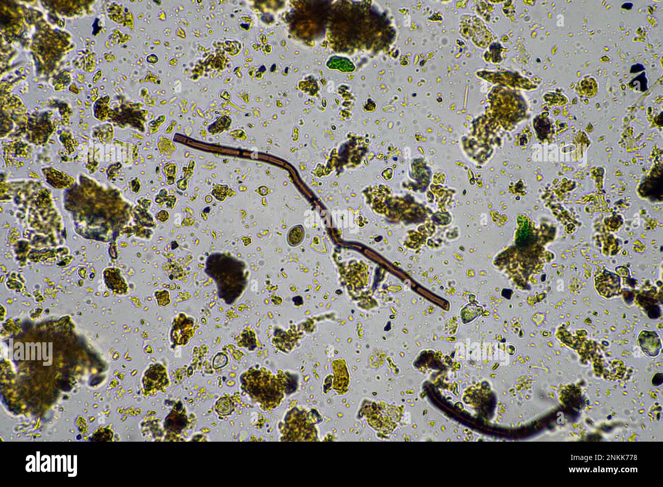 soil microorganisms in a soil sample, soil fungus and bacteria on a ...