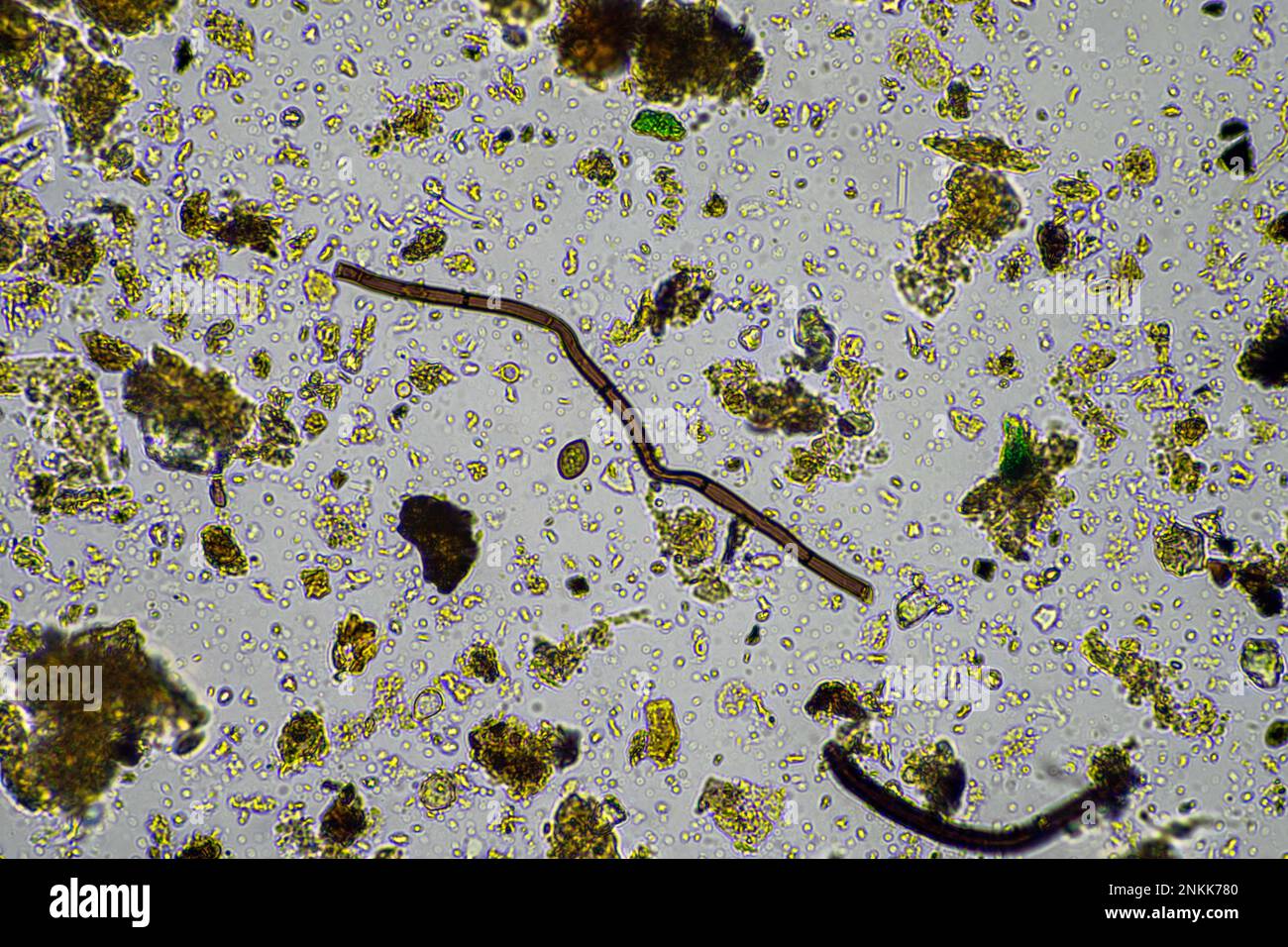 soil microorganisms in a soil sample, soil fungus and bacteria on a ...
