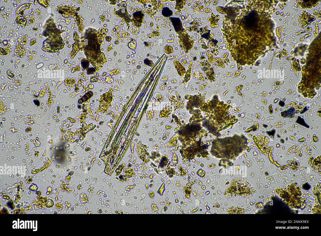 soil microorganisms in a soil sample, soil fungus and bacteria on a ...