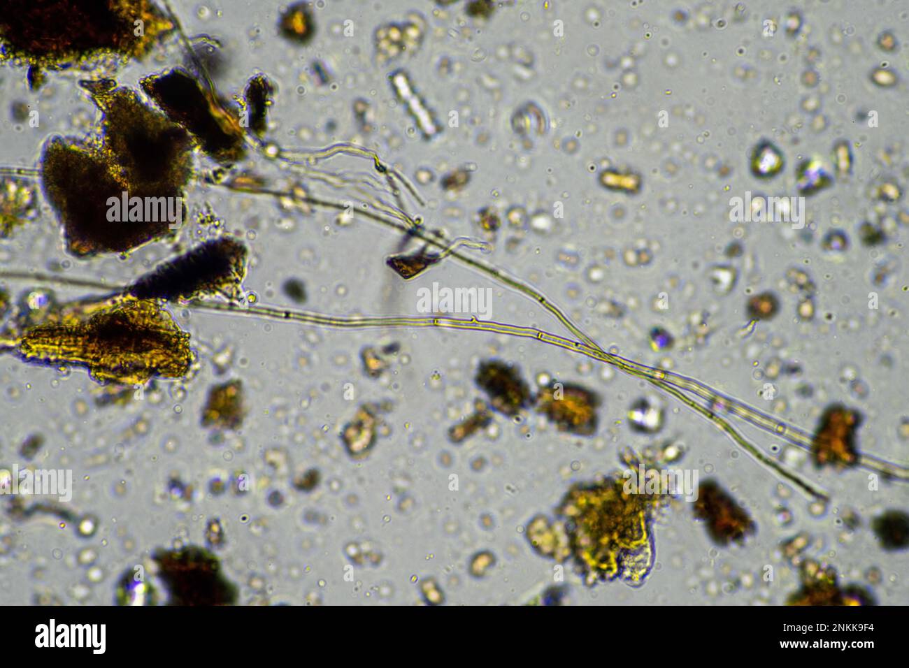 soil microorganisms in a soil sample, soil fungus and bacteria on a ...