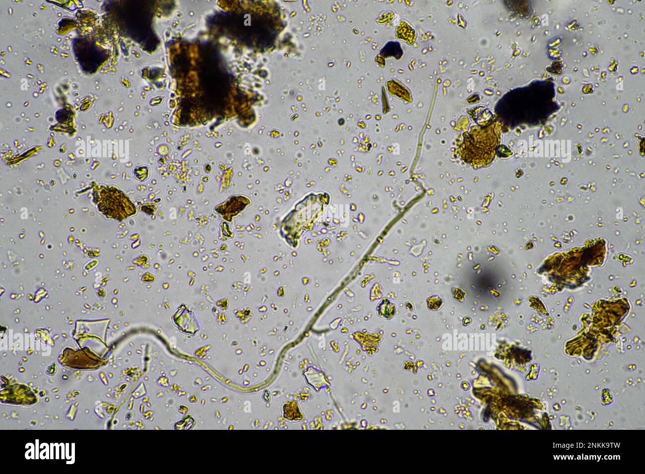 soil microorganisms in a soil sample, soil fungus and bacteria on a ...
