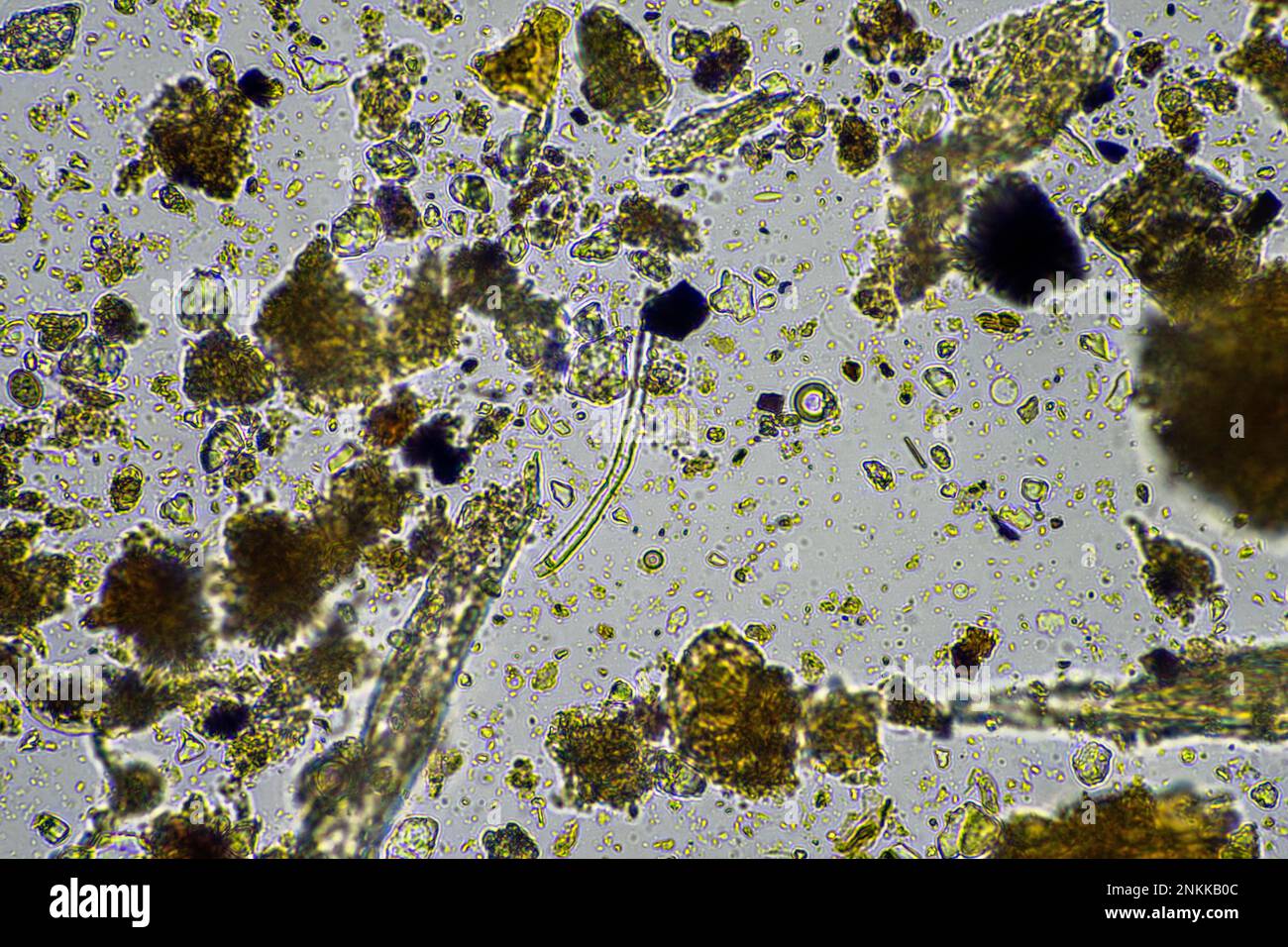 soil microorganisms in a soil sample, soil fungus and bacteria on a ...