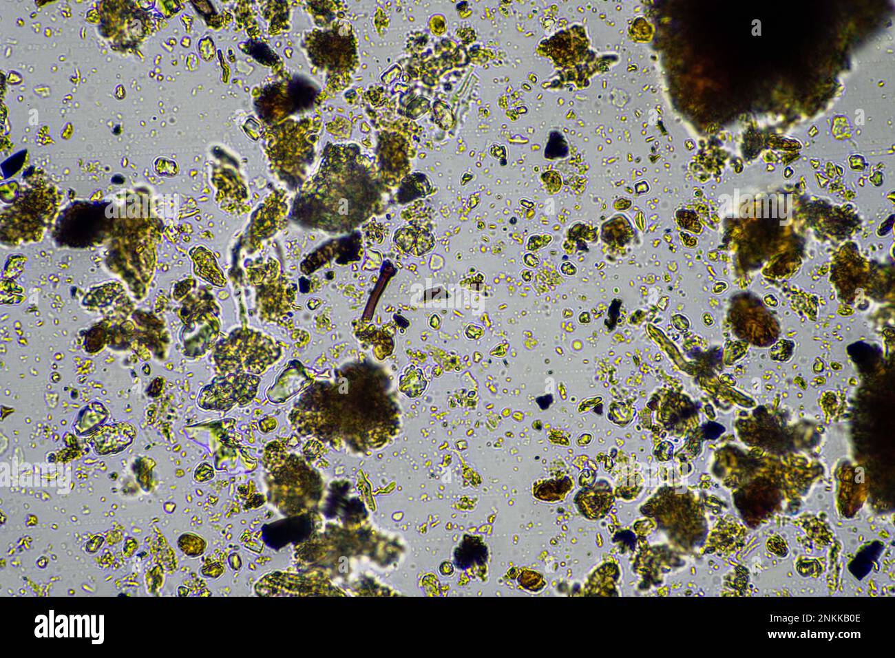 soil microorganisms in a soil sample, soil fungus and bacteria on a ...