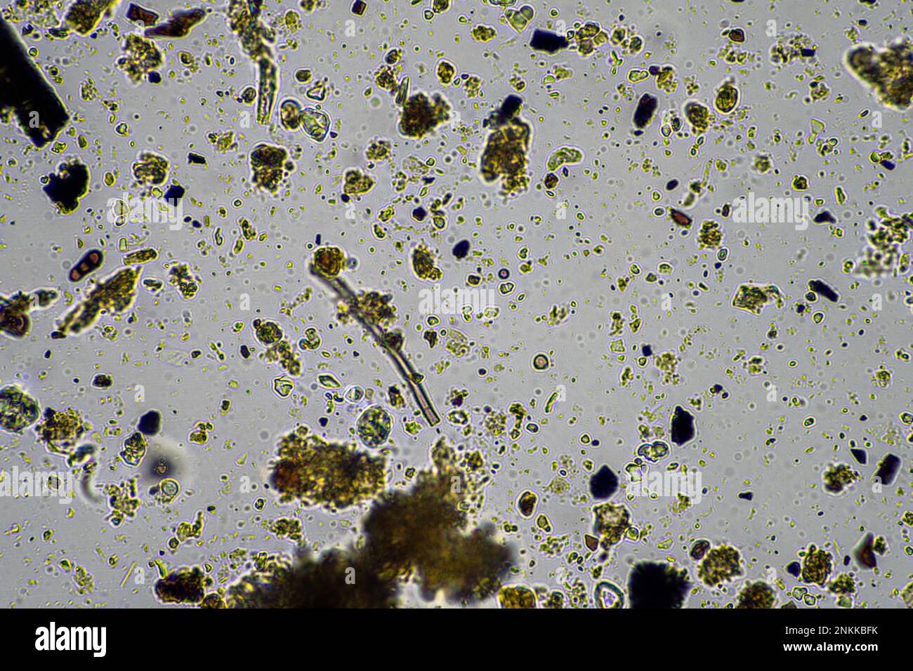 soil microorganisms in a soil sample, soil fungus and bacteria on a ...