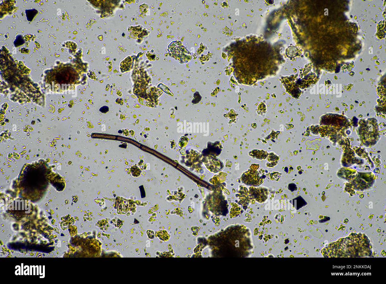 soil microorganisms in a soil sample, soil fungus and bacteria on a ...