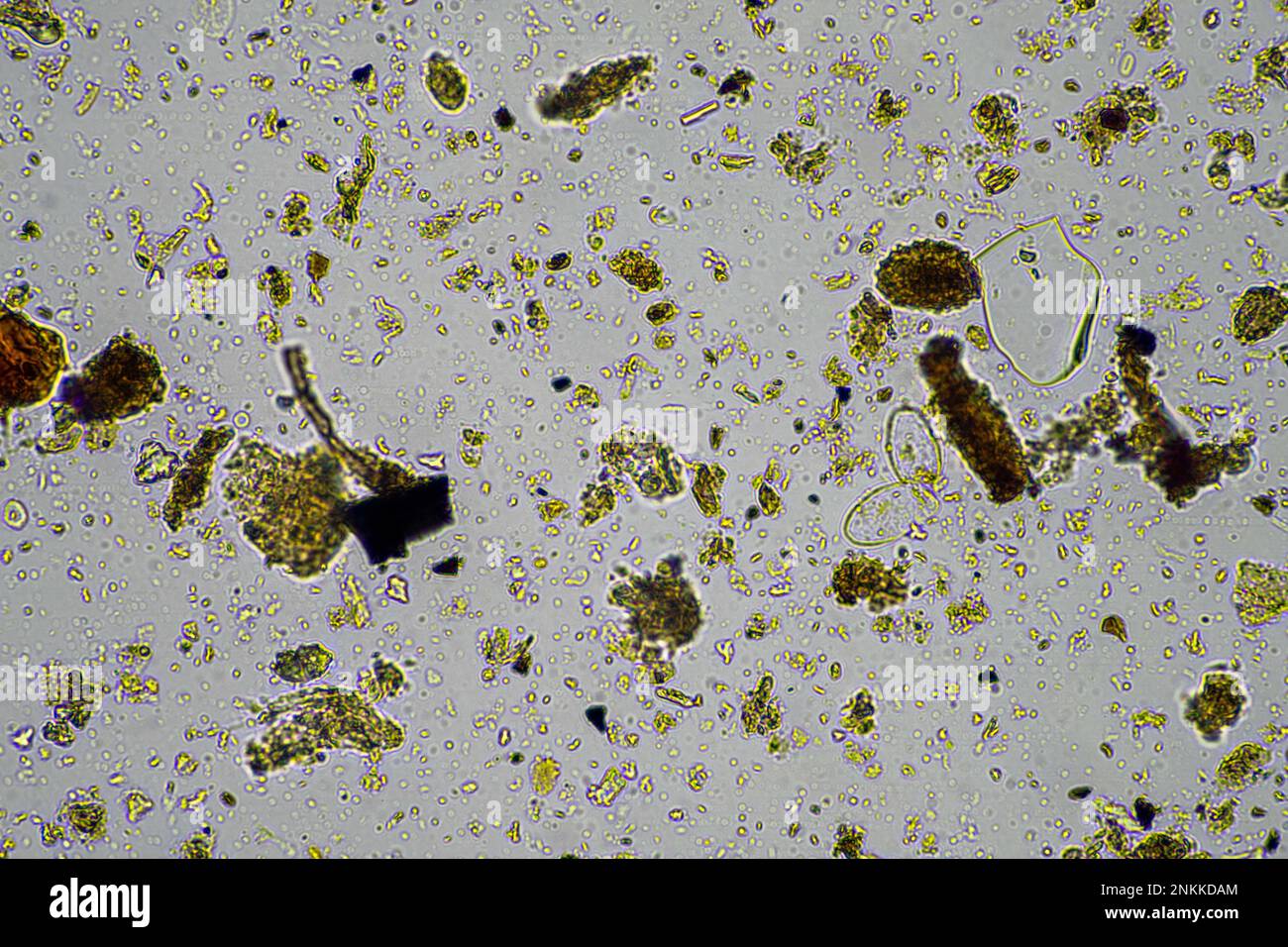 soil microorganisms in a soil sample, soil fungus and bacteria on a ...