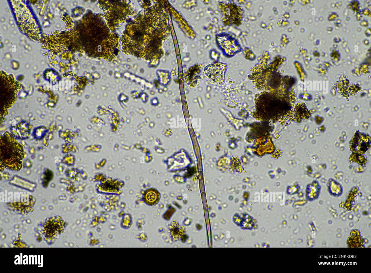 soil microorganisms in a soil sample, soil fungus and bacteria on a ...