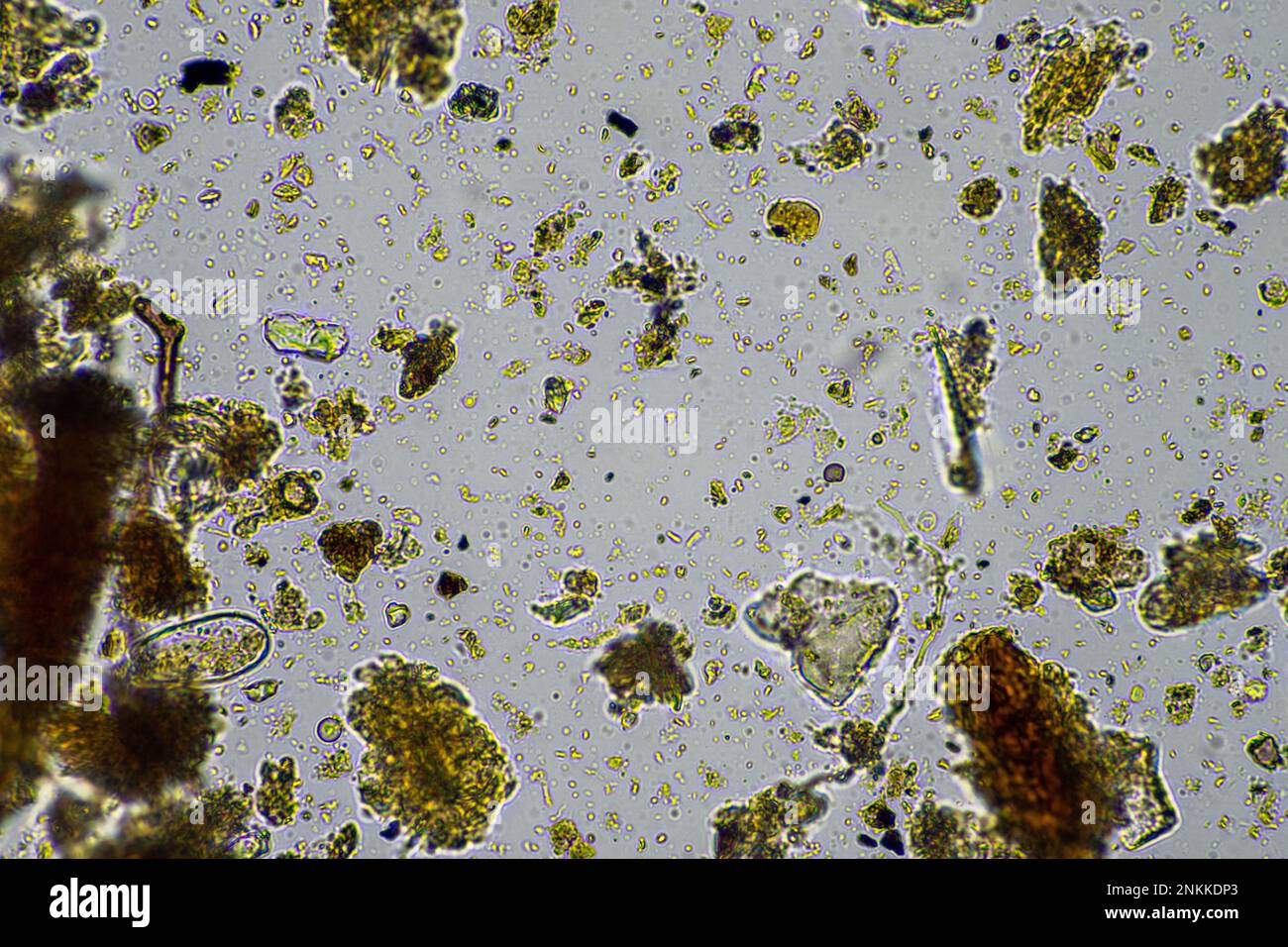 soil microorganisms in a soil sample, soil fungus and bacteria on a ...