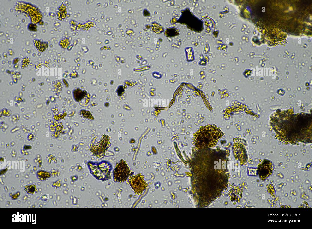 soil microorganisms in a soil sample, soil fungus and bacteria on a ...