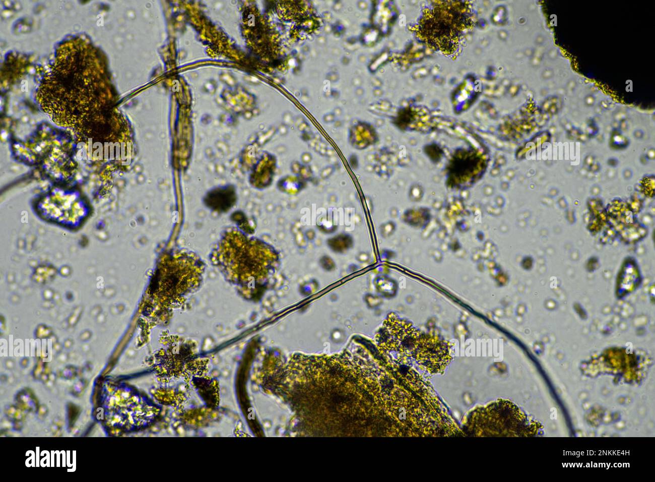 soil microorganisms in a soil sample, soil fungus and bacteria on a ...