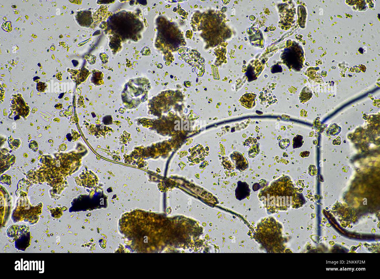 soil microorganisms in a soil sample, soil fungus and bacteria on a ...