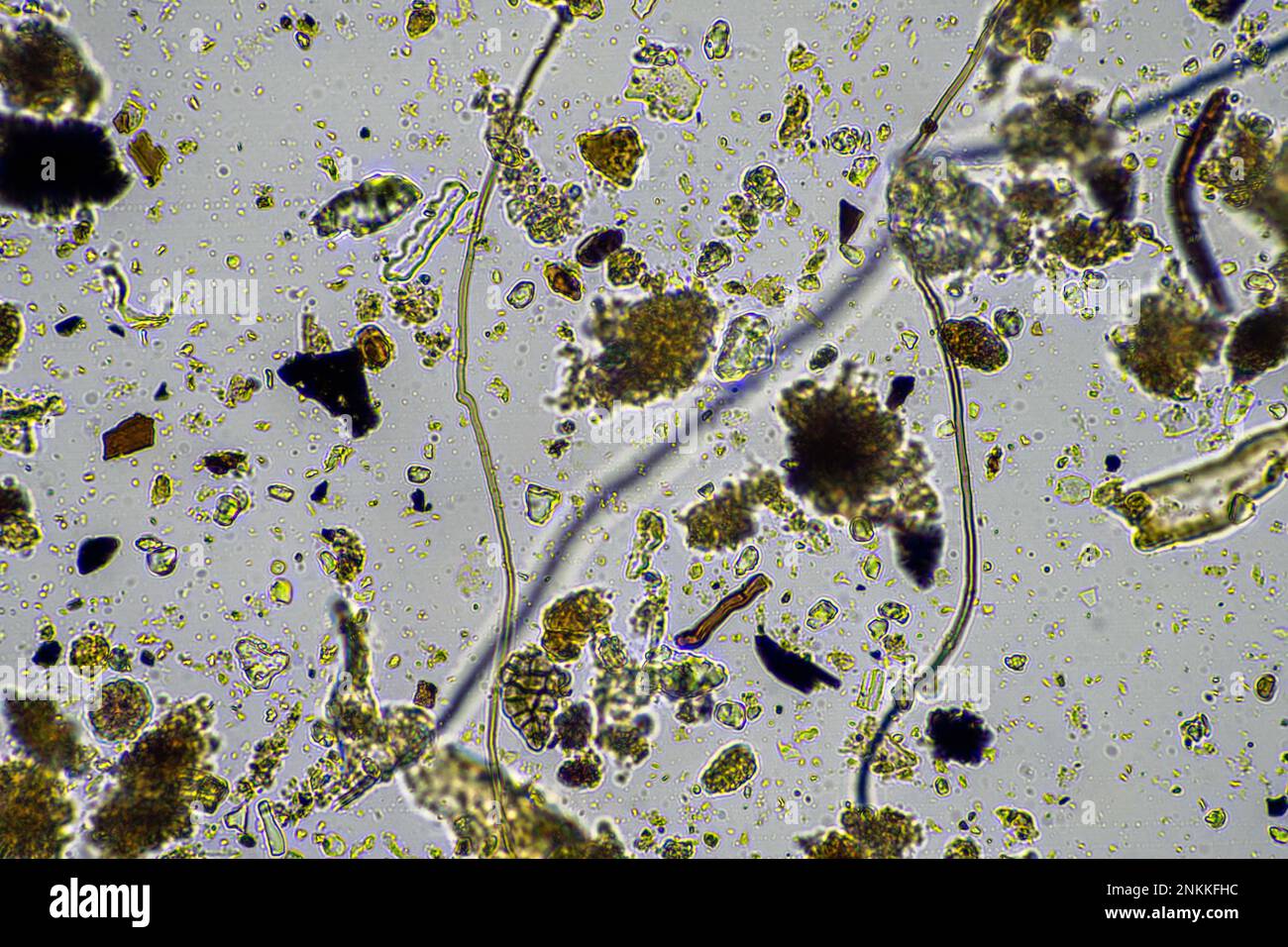 soil microorganisms in a soil sample, soil fungus and bacteria on a ...