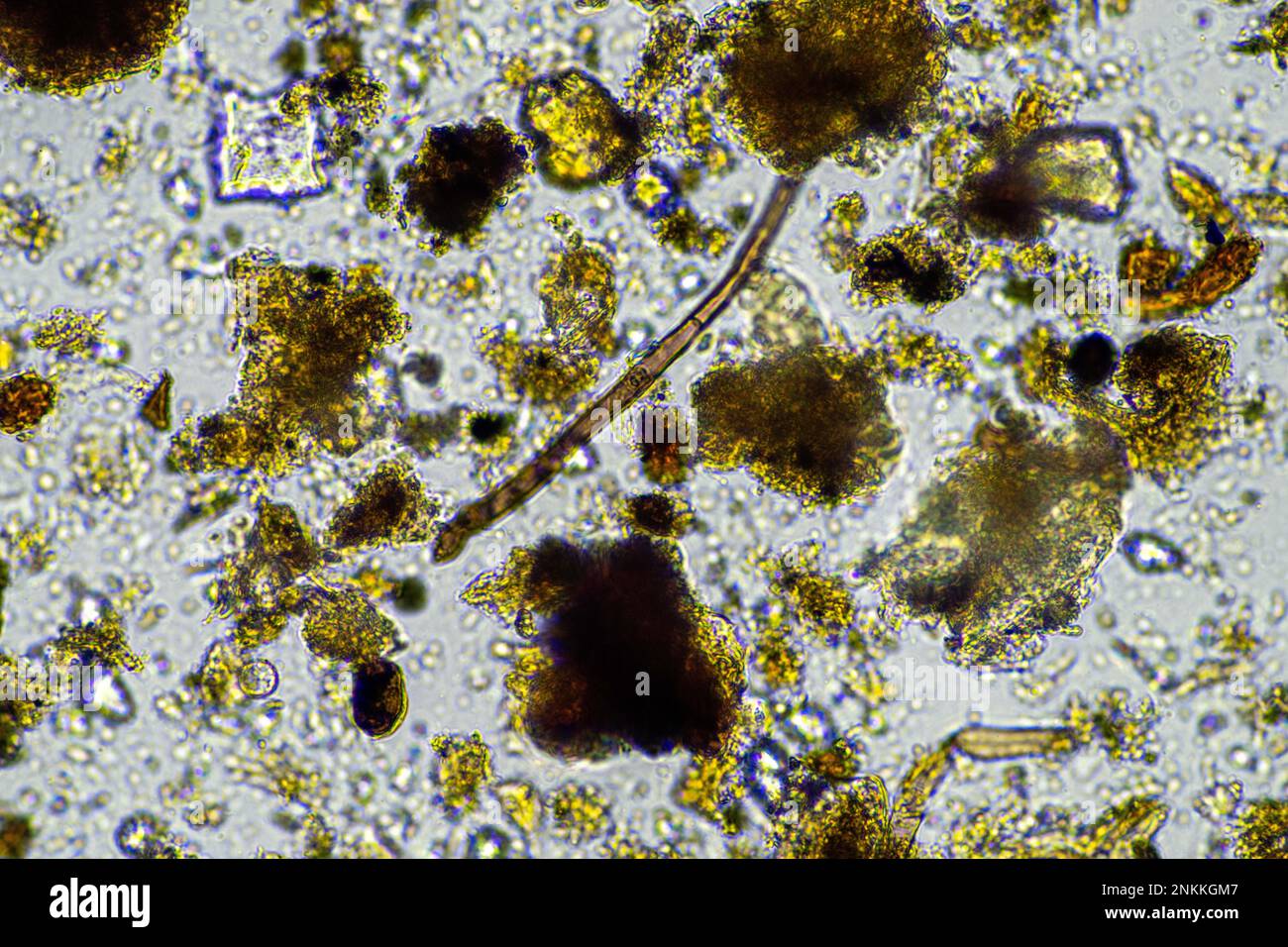soil microorganisms in a soil sample, soil fungus and bacteria on a ...