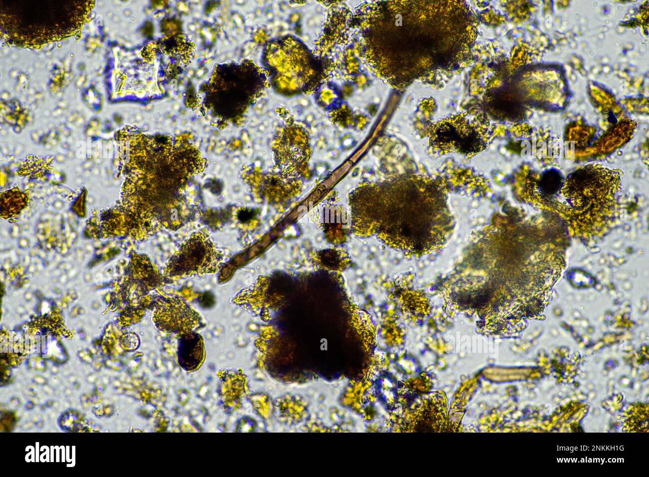 soil microorganisms in a soil sample, soil fungus and bacteria on a ...